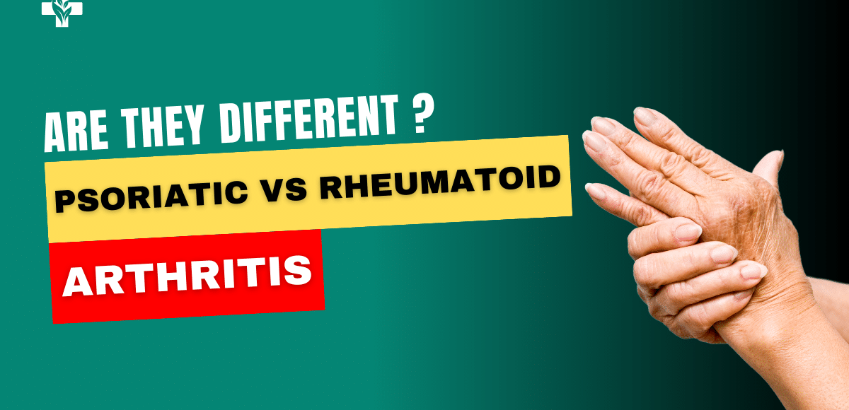 Psoriatic Arthritis Vs Rheumatoid Arthritis: The Major Differences