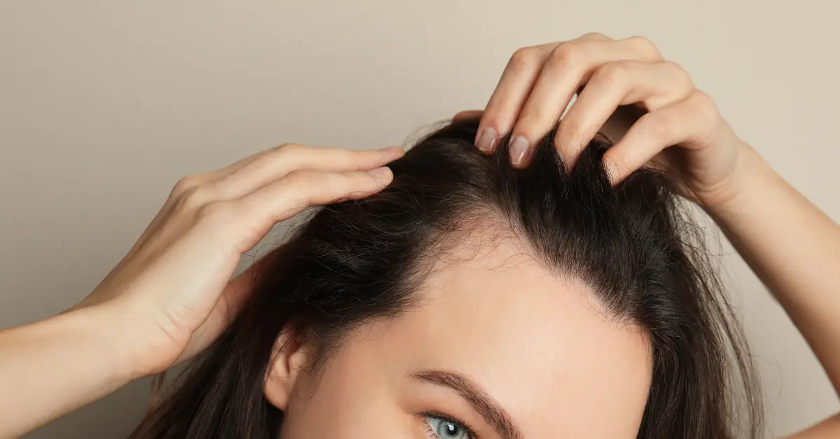 Dealing with Female Pattern Baldness: A Comprehensive Guide