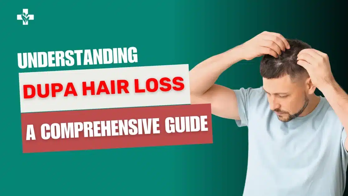 Complete Guide to DUPA Hair Loss