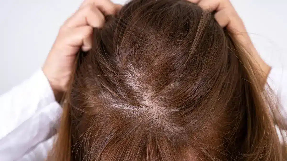 Fine Hair vs Thin Hair: How To Tell The Difference? Fine Hair vs Thin Hair: How To Tell The Difference?