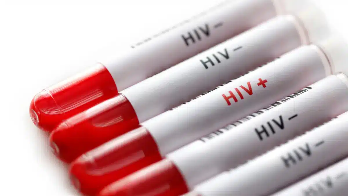 Understanding HIV Exposure: Risks, Prevention, and Importance of Timely ...