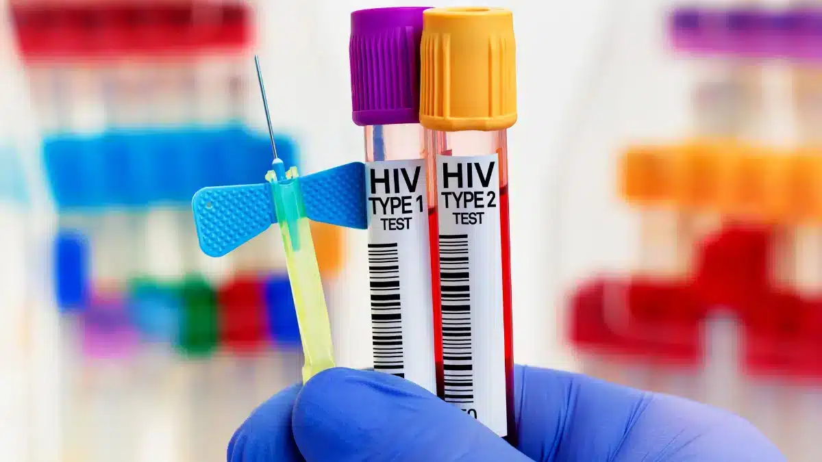 Understanding Variants: Exploring Different Types of HIV/AIDS Exist